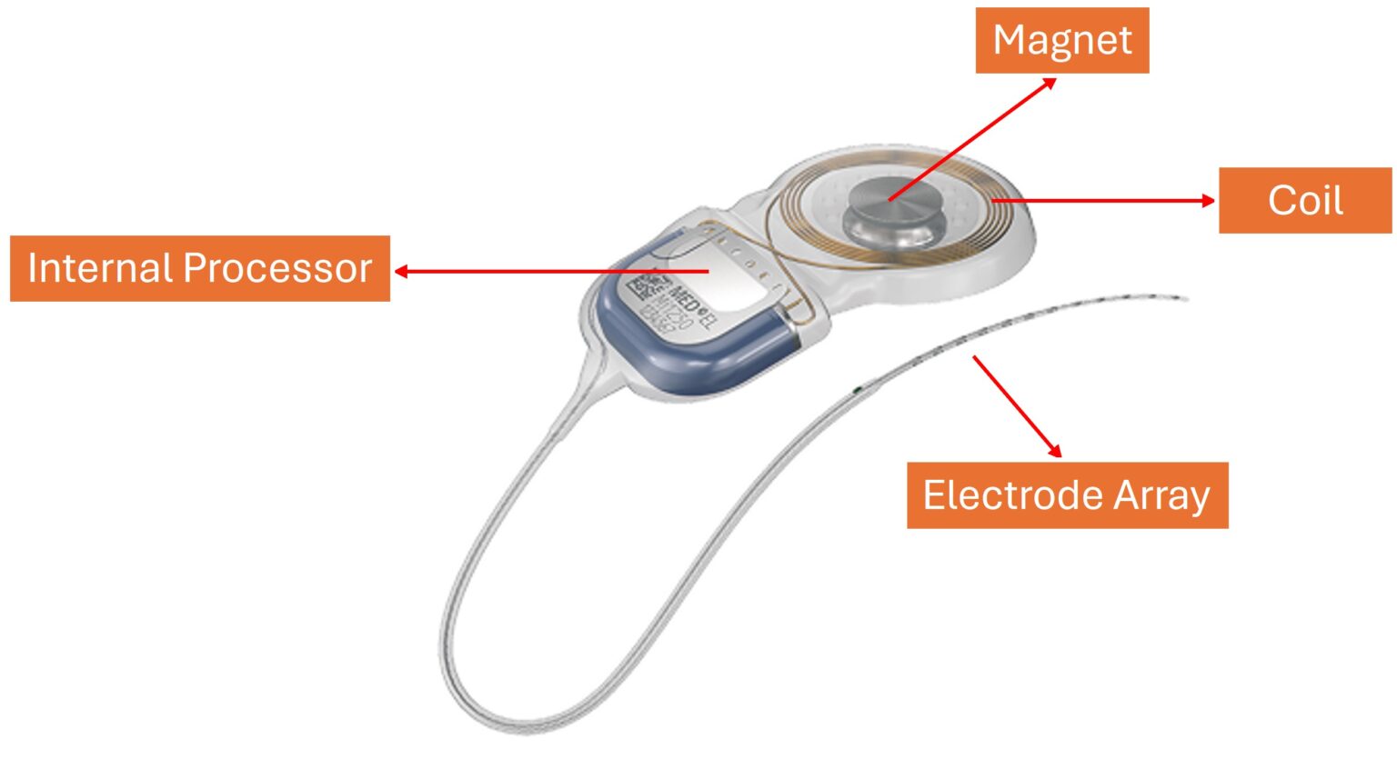 Reclaiming Sound, One Note at a Time – My Cochlear Implant Journey ...